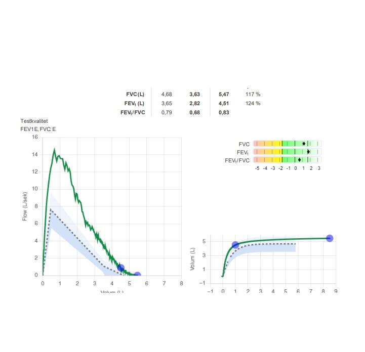 Spirare spirometri - Spirare